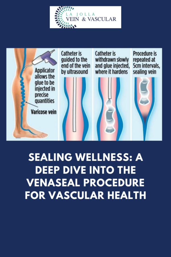 Kaiser Permanente Insurance Accepted for Vein Treatment